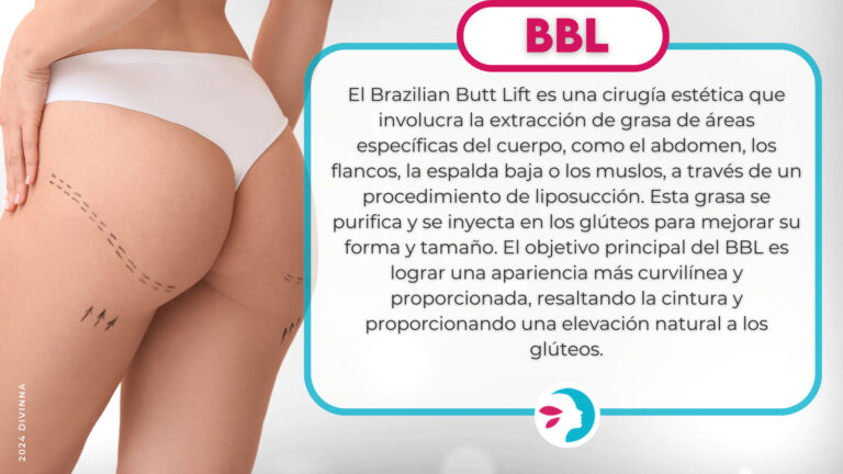 ¿Qué Es BBL?